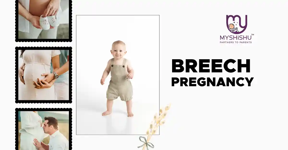 Breech Pregnancy: Celebrating the Unique Journey - MyShishu