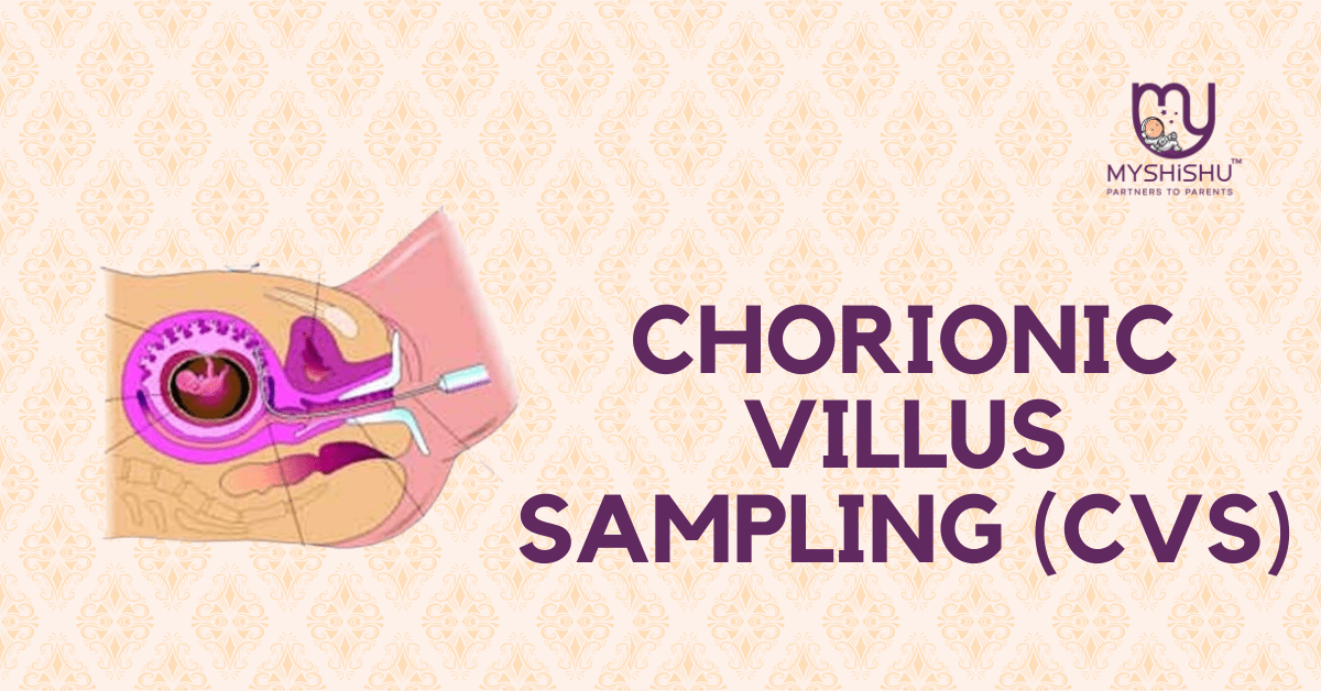 Unveiling Chorionic Villus Sampling (CVS): A Comprehensive Guide - MyShishu