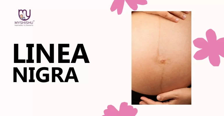 Linea Nigra In Pregnancy: A Comprehensive Guide - MyShishu